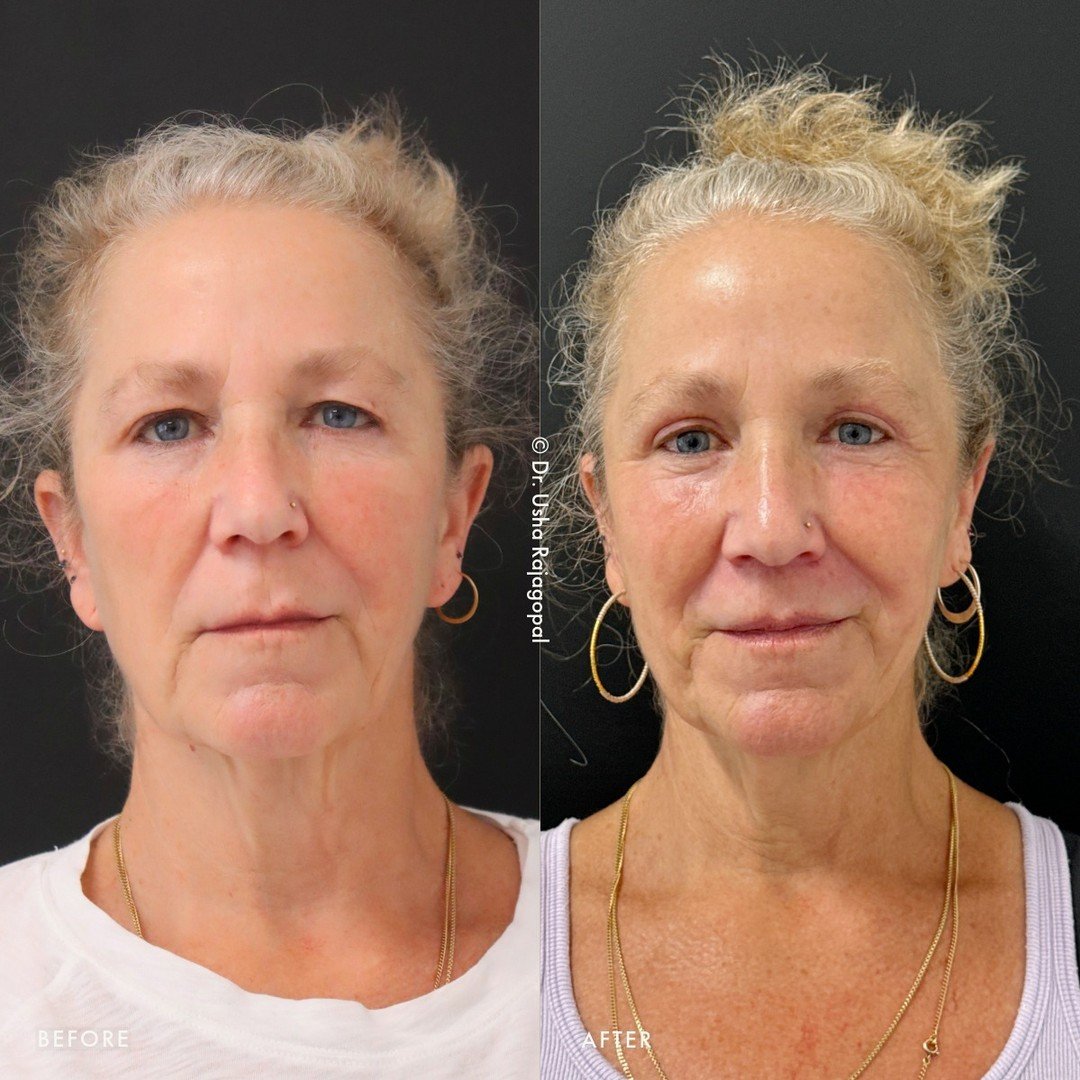 San Francisco Plastic Surgery & Laser Center | Usha Rajagopal, MD