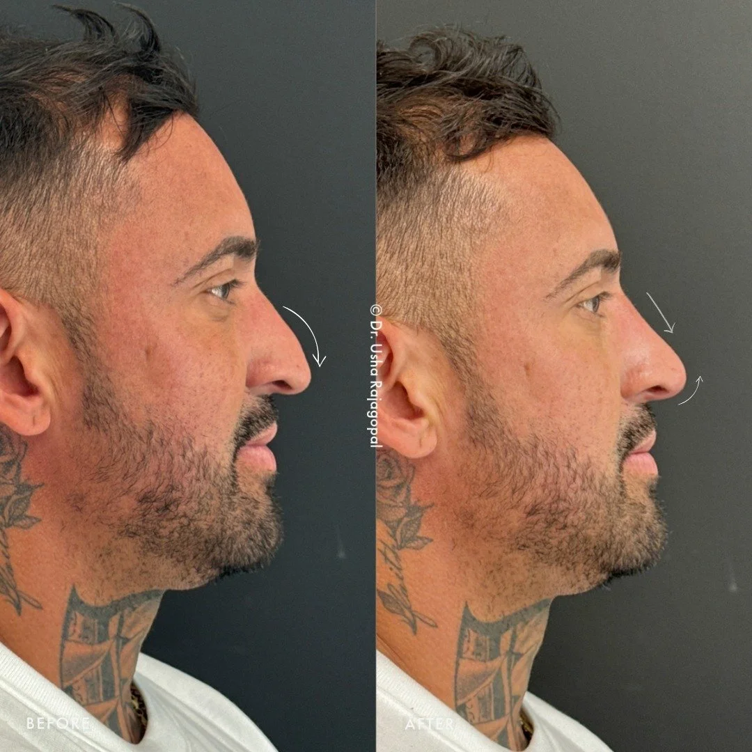 San Francisco Plastic Surgery & Laser Center | Usha Rajagopal, MD