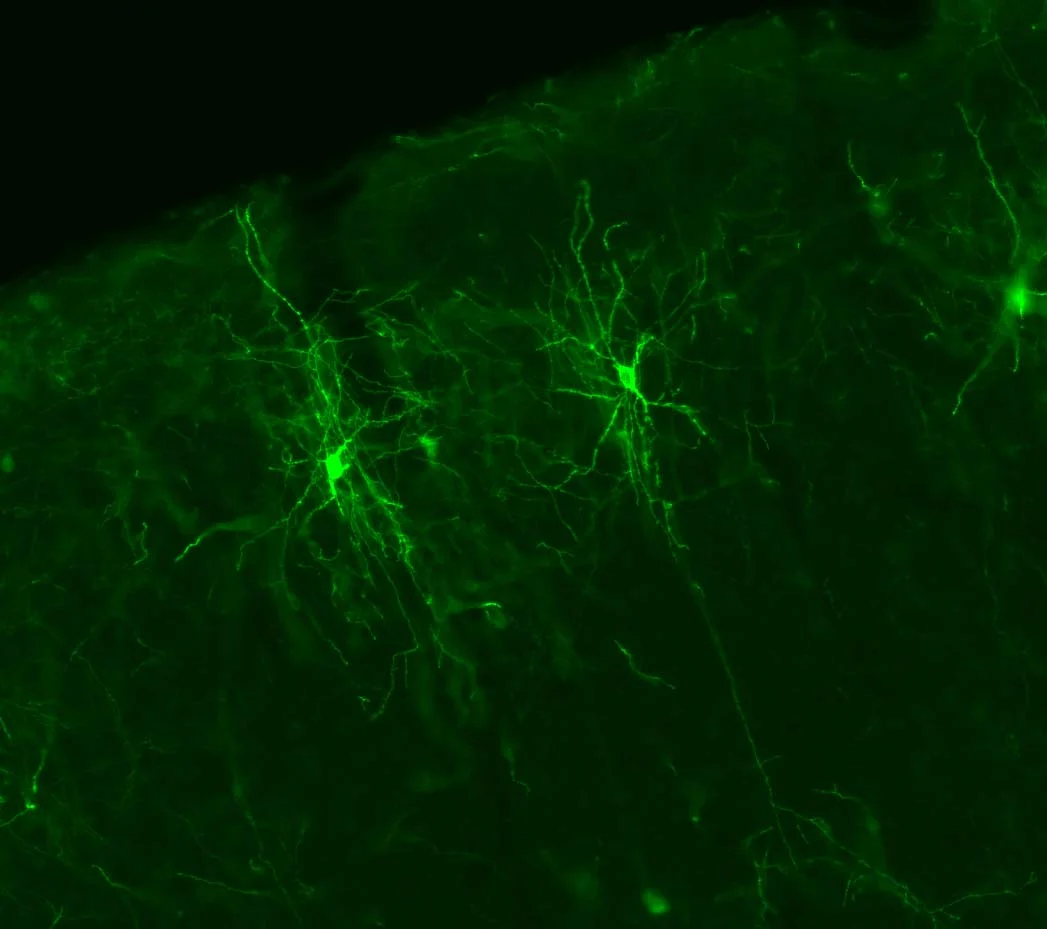 Anna Molofsky Lab @UCSF