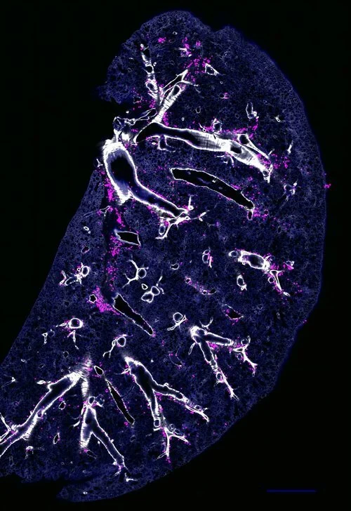 Research Projects — ARI MOLOFSKY LAB @ UCSF