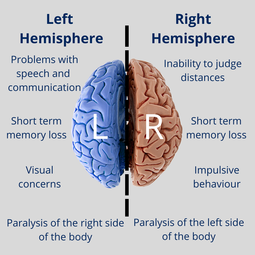 A Stroke Of Genius Stroke Prevention And Management Wellness A Stroke Of Genius Stroke Prevention And Management Wellness