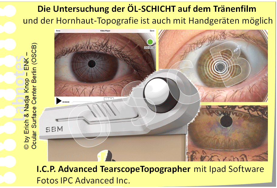 D-BLICK auf ... MEIBOMDRÜSEN — Ocular Surface Center Berlin