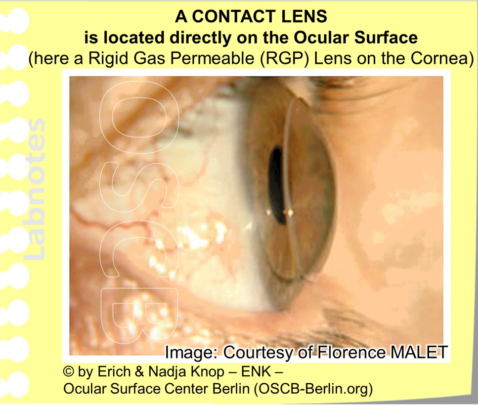 Deeper Insight Into Contact Lenses History Types Schedules