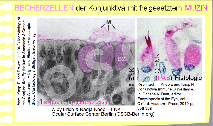 D-BLICK auf ... die AUGENOBERFLÄCHE — Ocular Surface Center Berlin