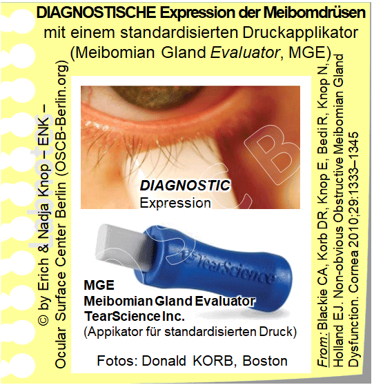 DIAGNOSIS - Clinical TESTS — Ocular Surface Center Berlin