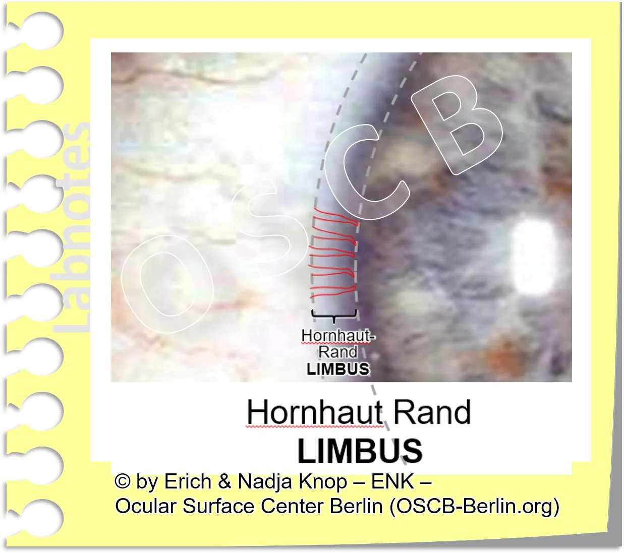 D-BLICK auf ... die AUGENOBERFLÄCHE — Ocular Surface Center Berlin