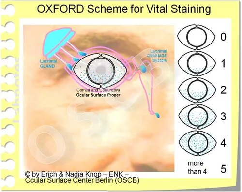 DIAGNOSE - Klinische TESTS — Ocular Surface Center Berlin