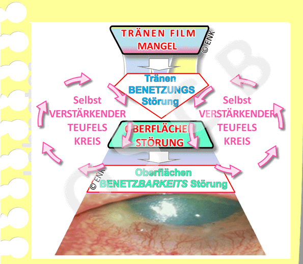 ESSENTIALS for Dry Eyes — Ocular Surface Center Berlin