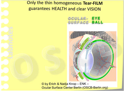 ESSENTIALS for Dry Eyes — Ocular Surface Center Berlin