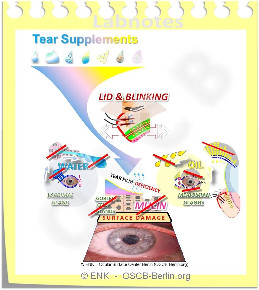 Tear SUPPLEMENTS - Overview - If? - When? - Why? - What? — Ocular ...