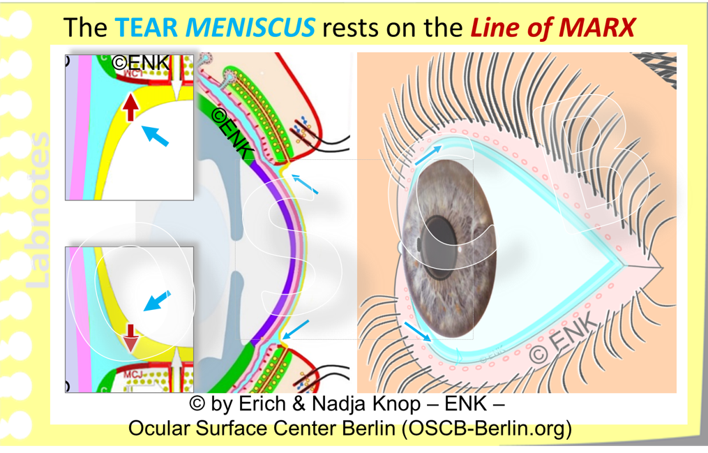 OVERVIEW on ...the Lid Margin — Ocular Surface Center Berlin