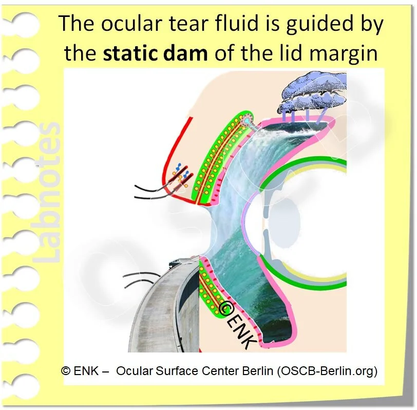 GLIMPSE on the LID MARGIN — Ocular Surface Center Berlin