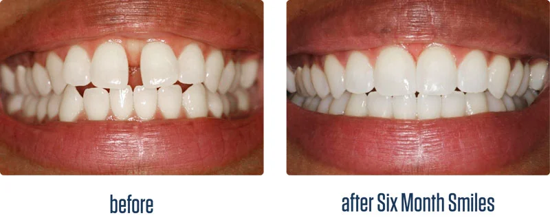 Treatments — Carshalton Park Dental Practice