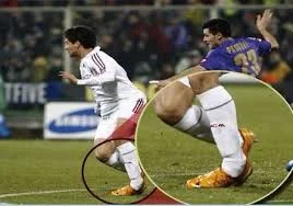 Sprained Ankle Football