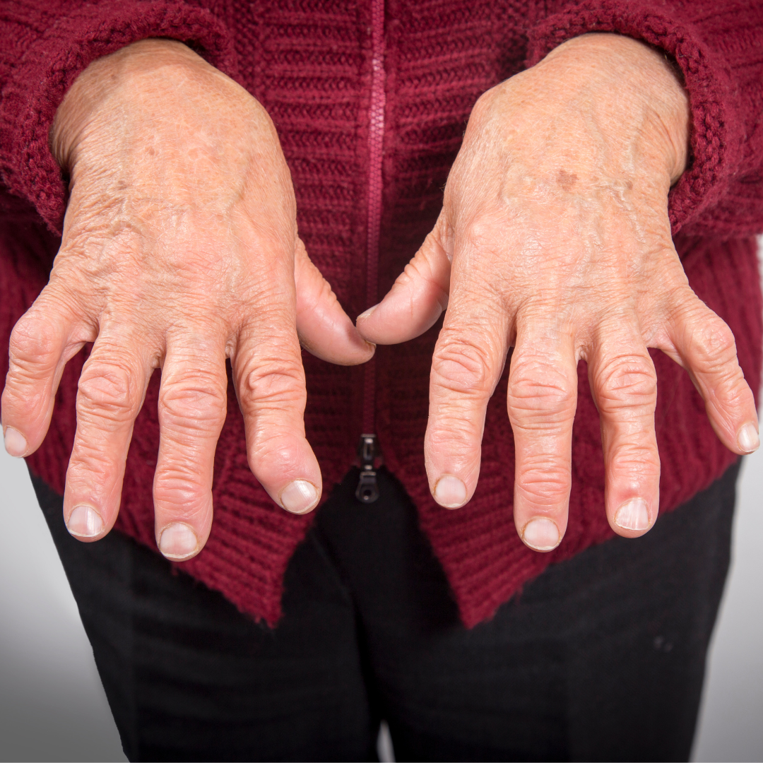 Rheumatological Conditions & Chronic Pain — Total Physiotherapy
