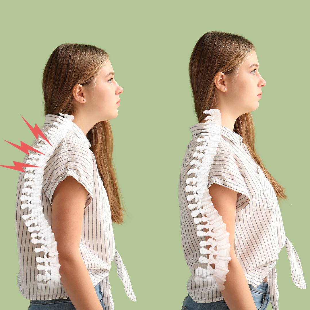 Unlock Better Health: Correct the Most Common Posture Mistake by ...