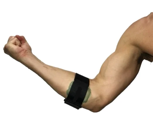 Medial Epicondylitis - Golfer's Elbow - Raleigh Hand Surgery — Joseph J ...