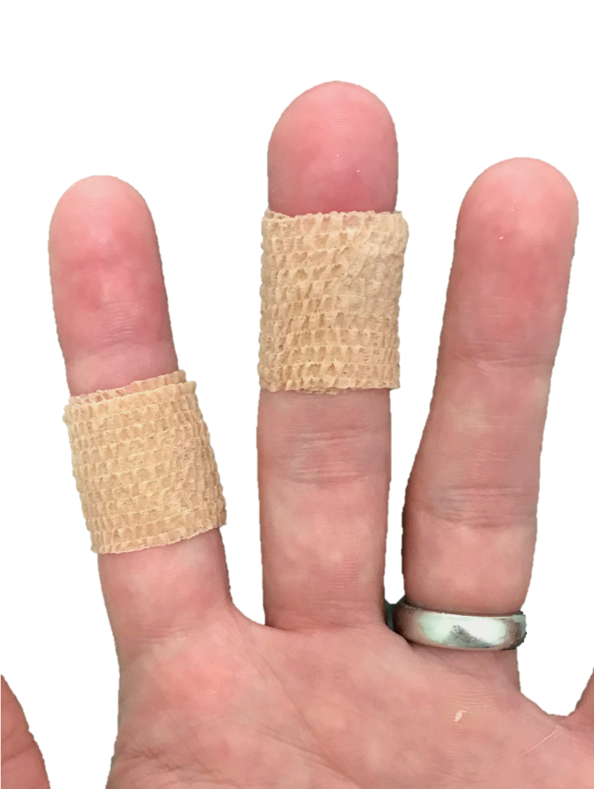 Trigger Finger - Raleigh Hand Surgery — Joseph J. Schreiber, MD