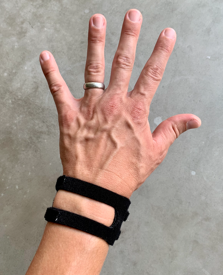 TFCC Tear - Raleigh Hand Surgery — Joseph J. Schreiber, MD