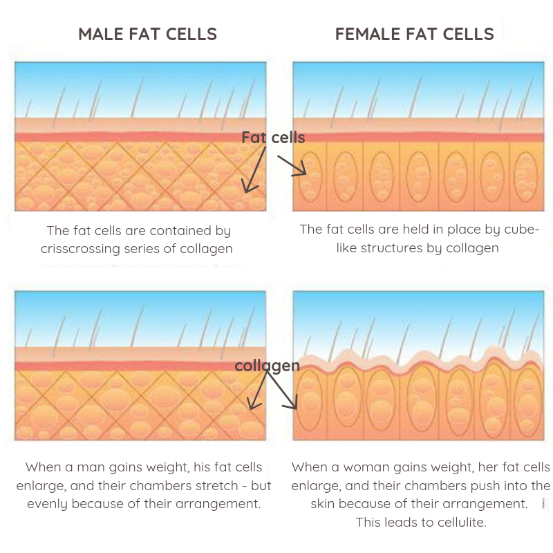 The Ultimate Guide To Get Rid Of Cellulite Naturally — Hanne Robinson