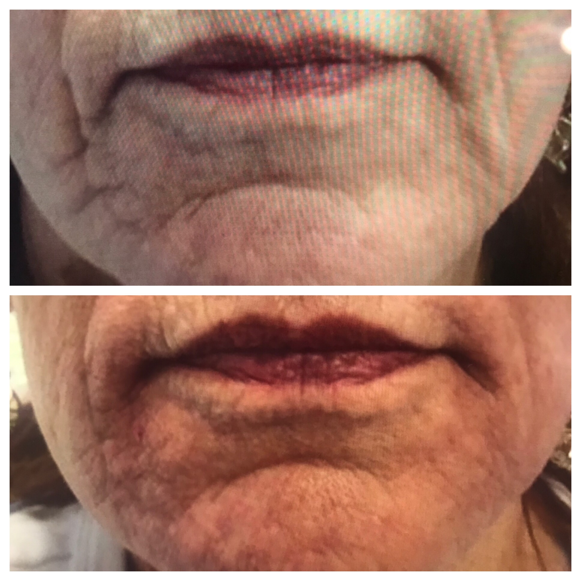 Cosmetic Treatments — Village Dermatology