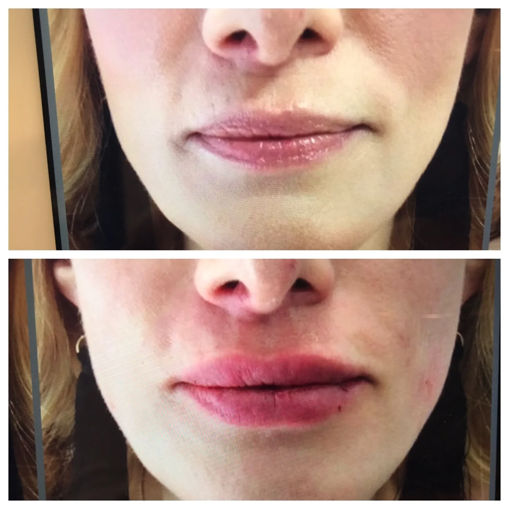 Refyne & Defyne — Village Dermatology