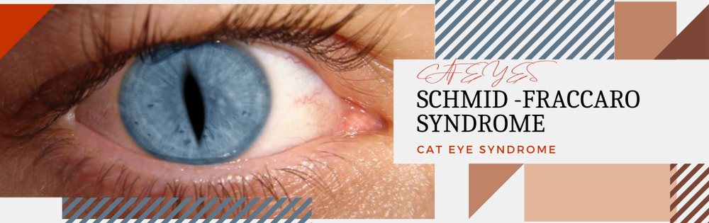 Schmid Fraccaro Syndrome