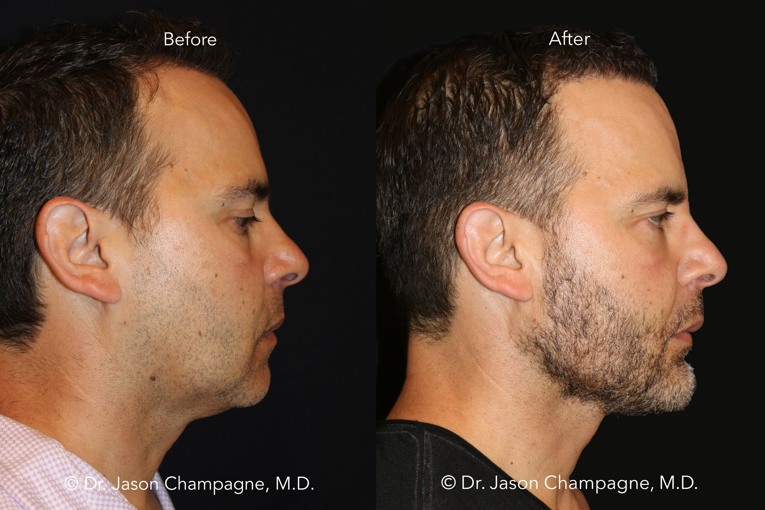 The New You - Before and After - Dr. Jason Champagne