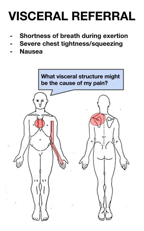 Visceral Pain Referral — James McAfee, PT, DPT