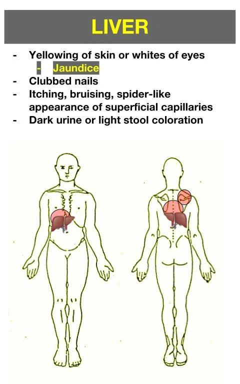 Visceral Pain Referral — James McAfee, PT, DPT