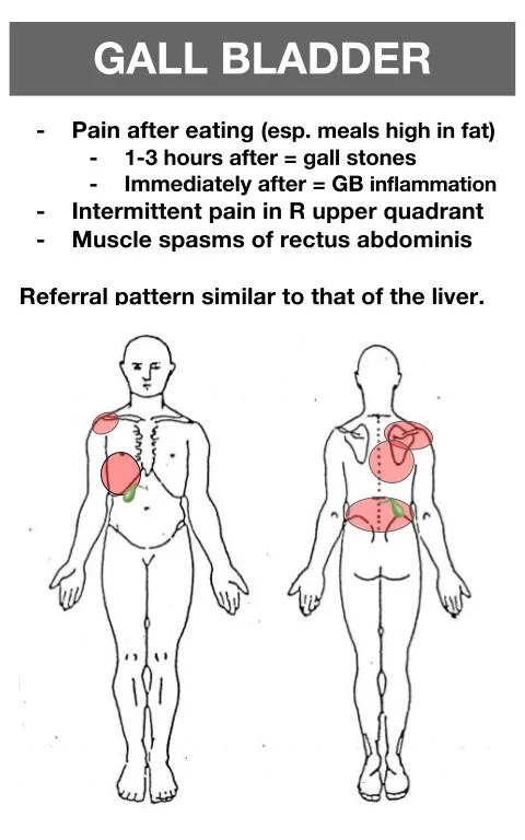 Gallbladder Referred Pain Chart How To Stop Your Gallbladder Pain In