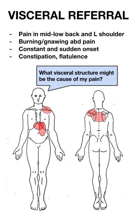 Visceral Pain Referral — James McAfee, PT, DPT