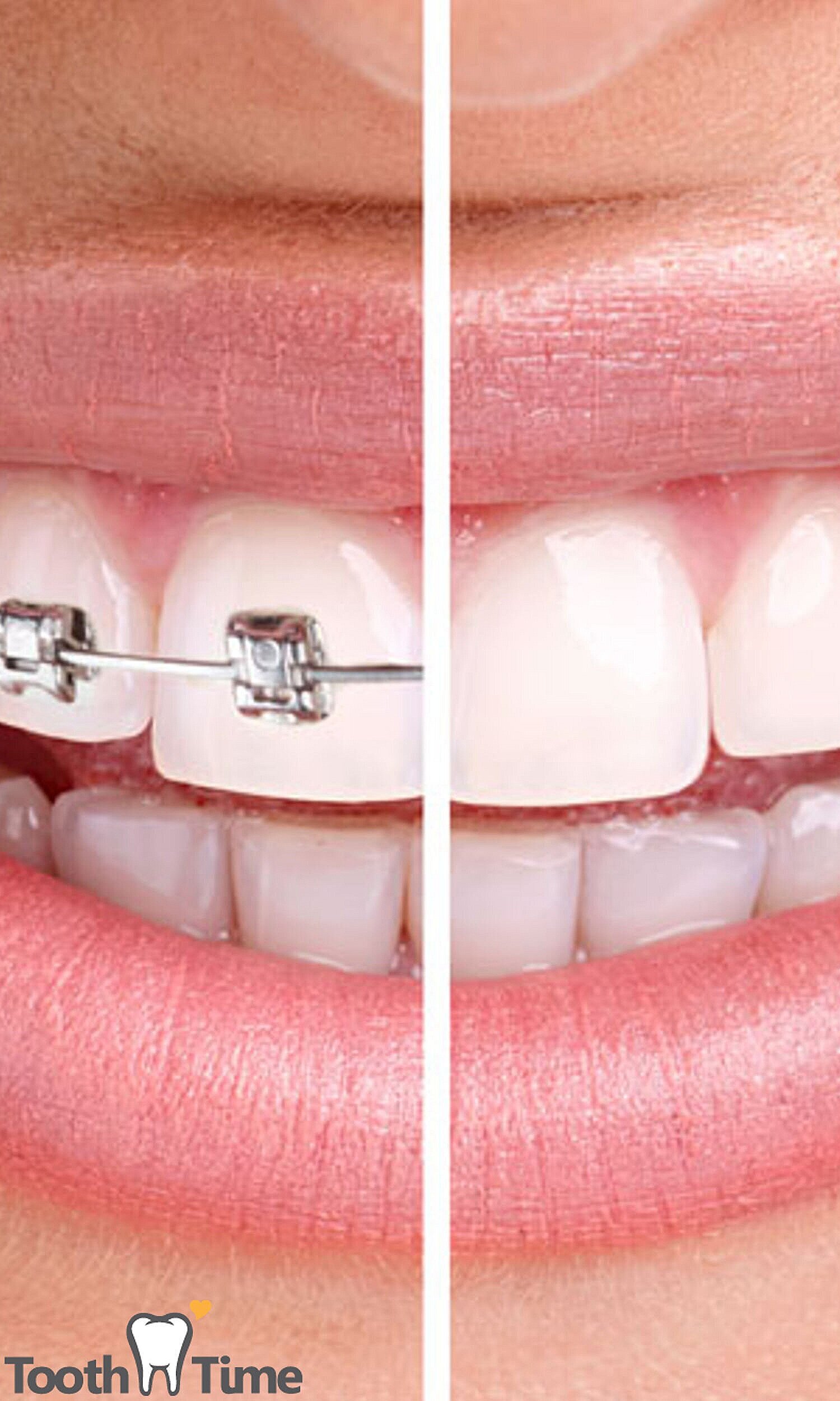 Affordable Family Dentist - Toothtime