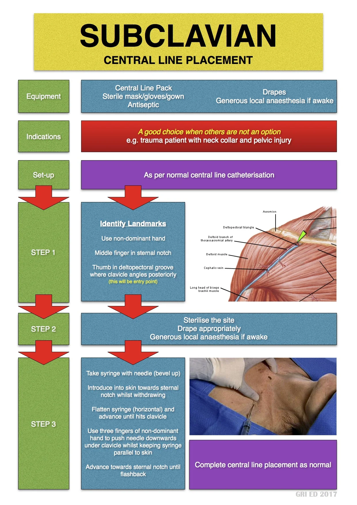 St Mungo s Subclavian Line St Mungo s Subclavian Line