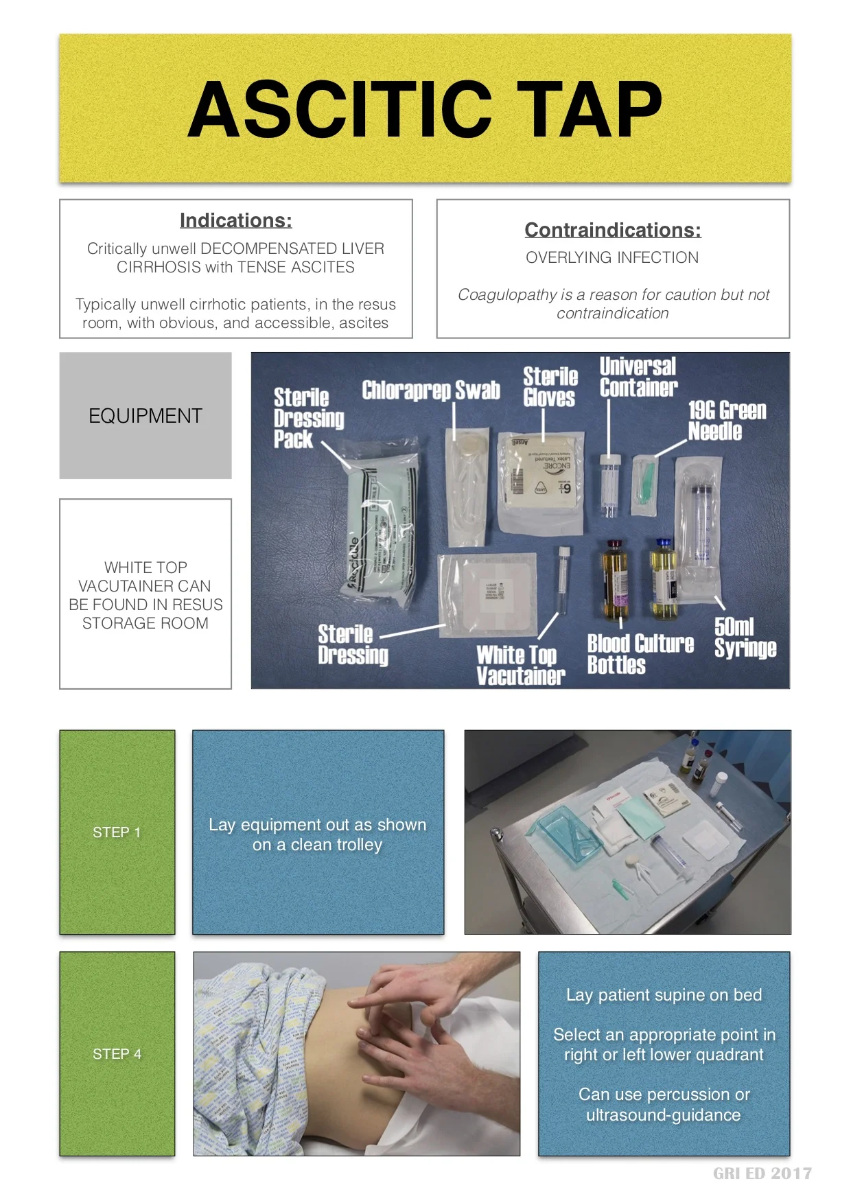 st mungo's-Ascitic Tap