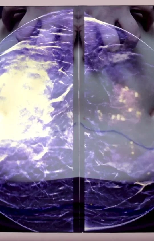 SCP #74: Needle And Skin — Erica Bramham