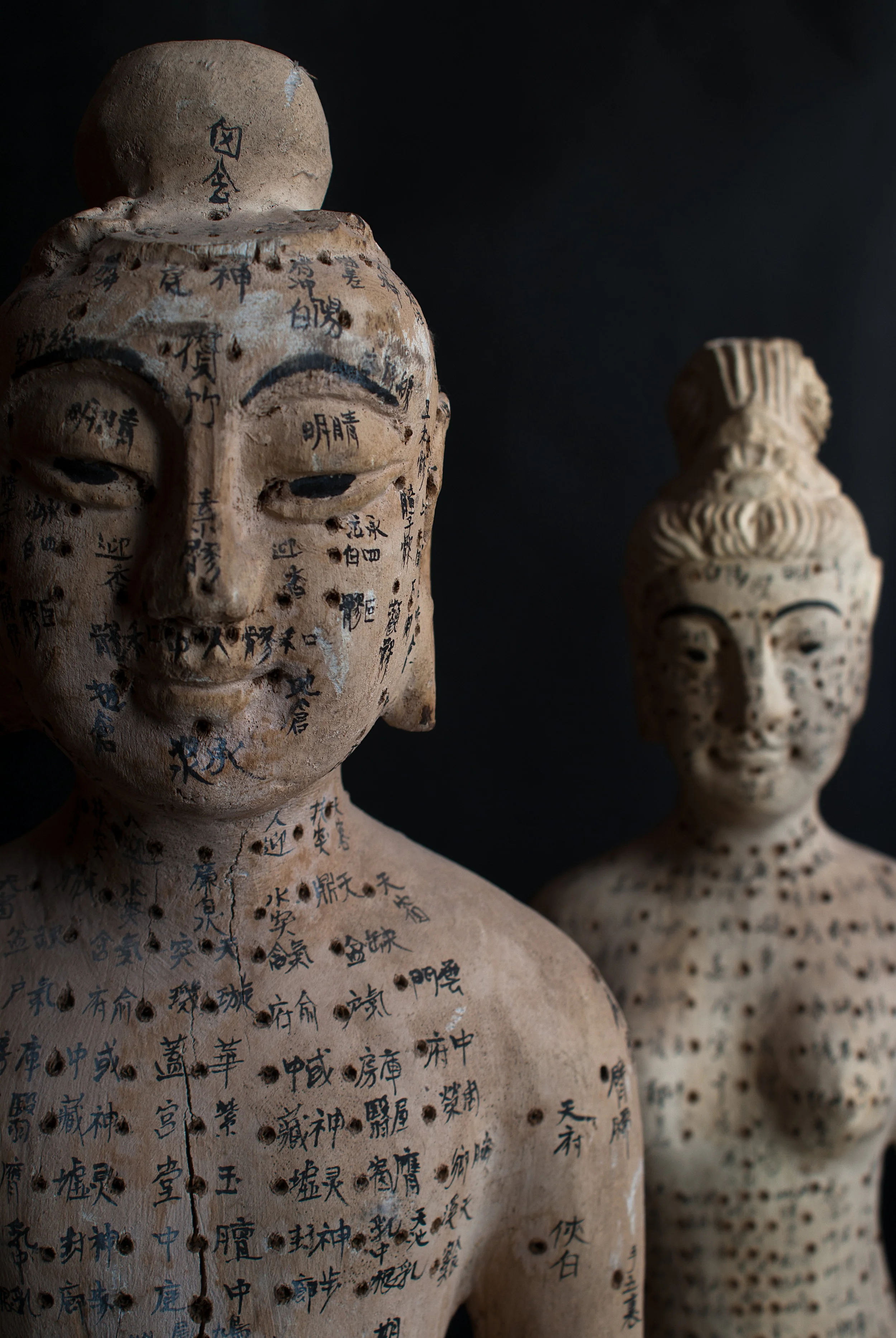 Art of Acupuncture