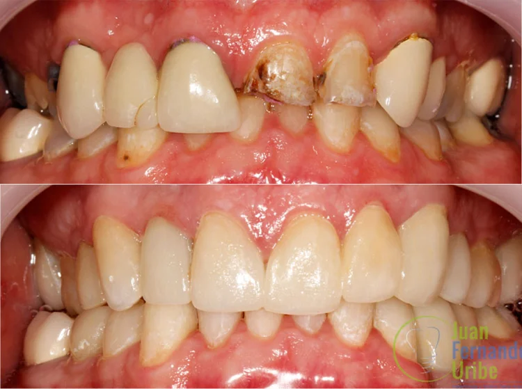 Not All Cosmetic Dentists in Cali Are Created Equal | Dental Tourism ...