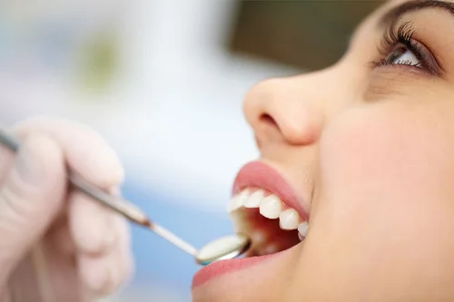 The Price of Teeth Whitening in Cartagena - Dental Tourism Colombia