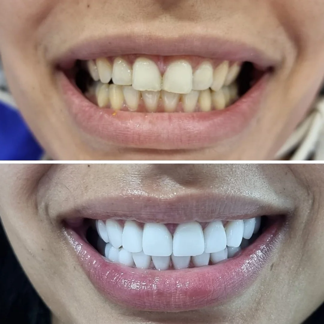 How to find the best dentist in Cali, Colombia for you | Dental Tourism ...