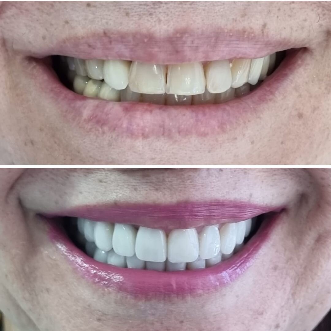 Reviews — Dental Tourism Colombia