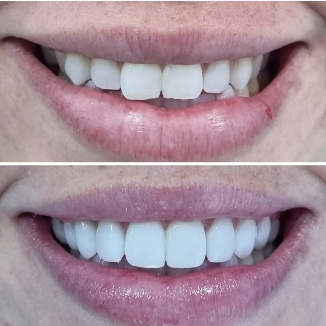 Reviews — Dental Tourism Colombia