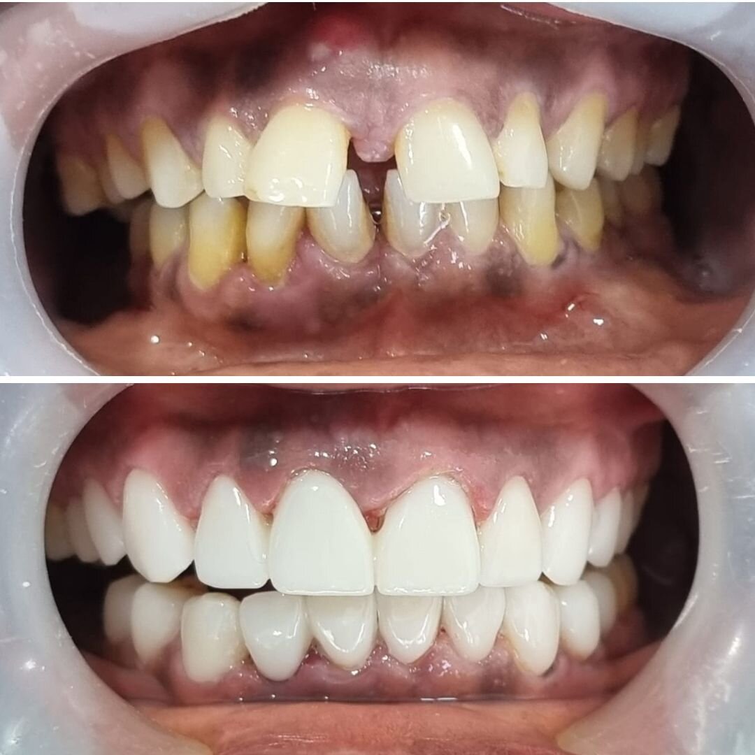Reviews — Dental Tourism Colombia