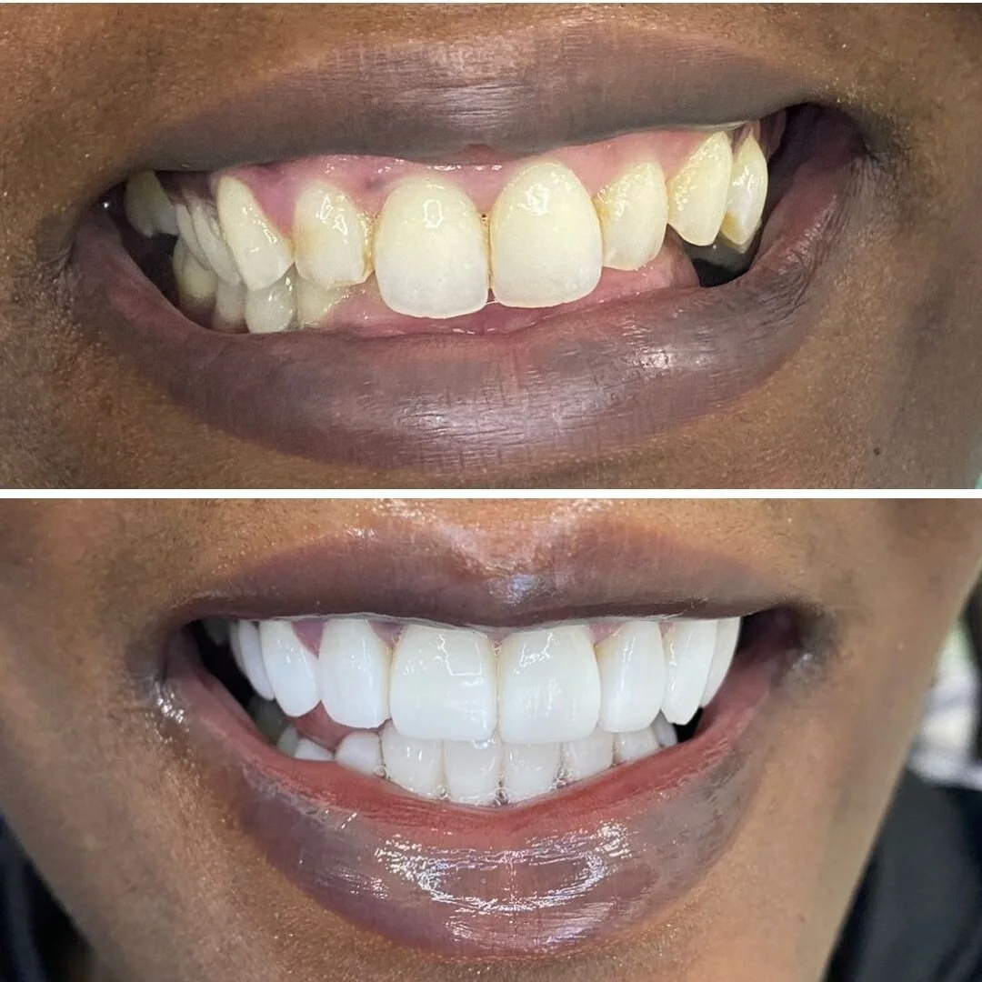 Reviews — Dental Tourism Colombia