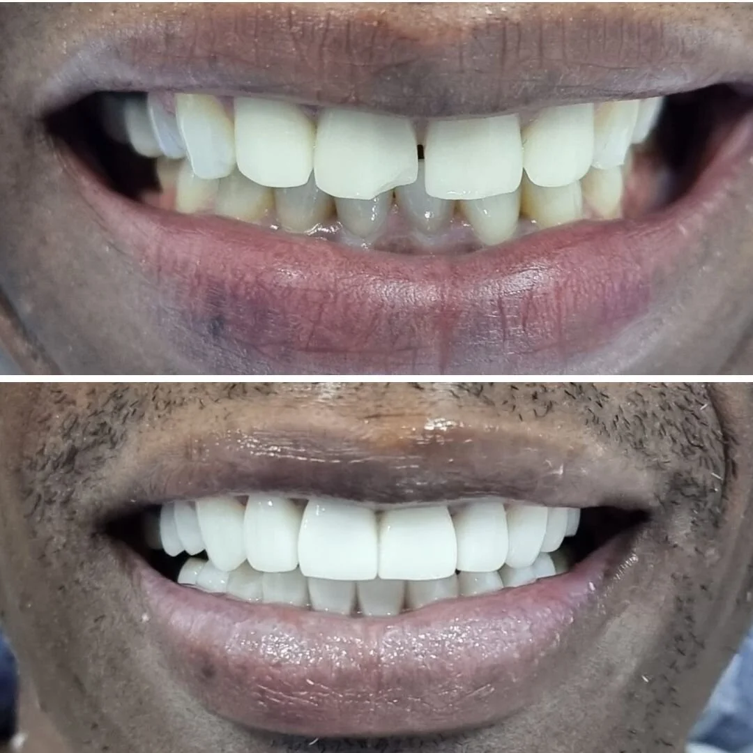 Reviews — Dental Tourism Colombia