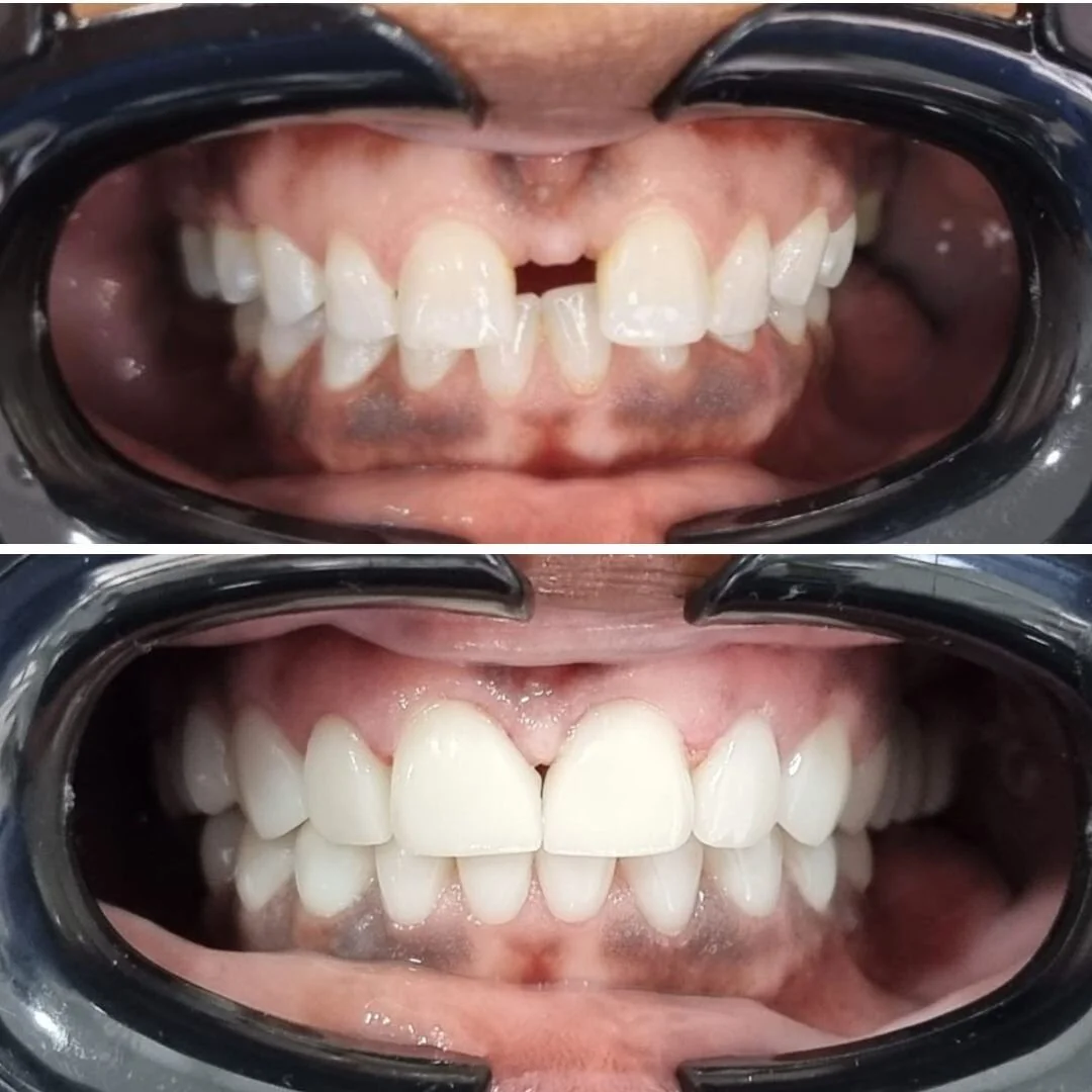 Reviews — Dental Tourism Colombia