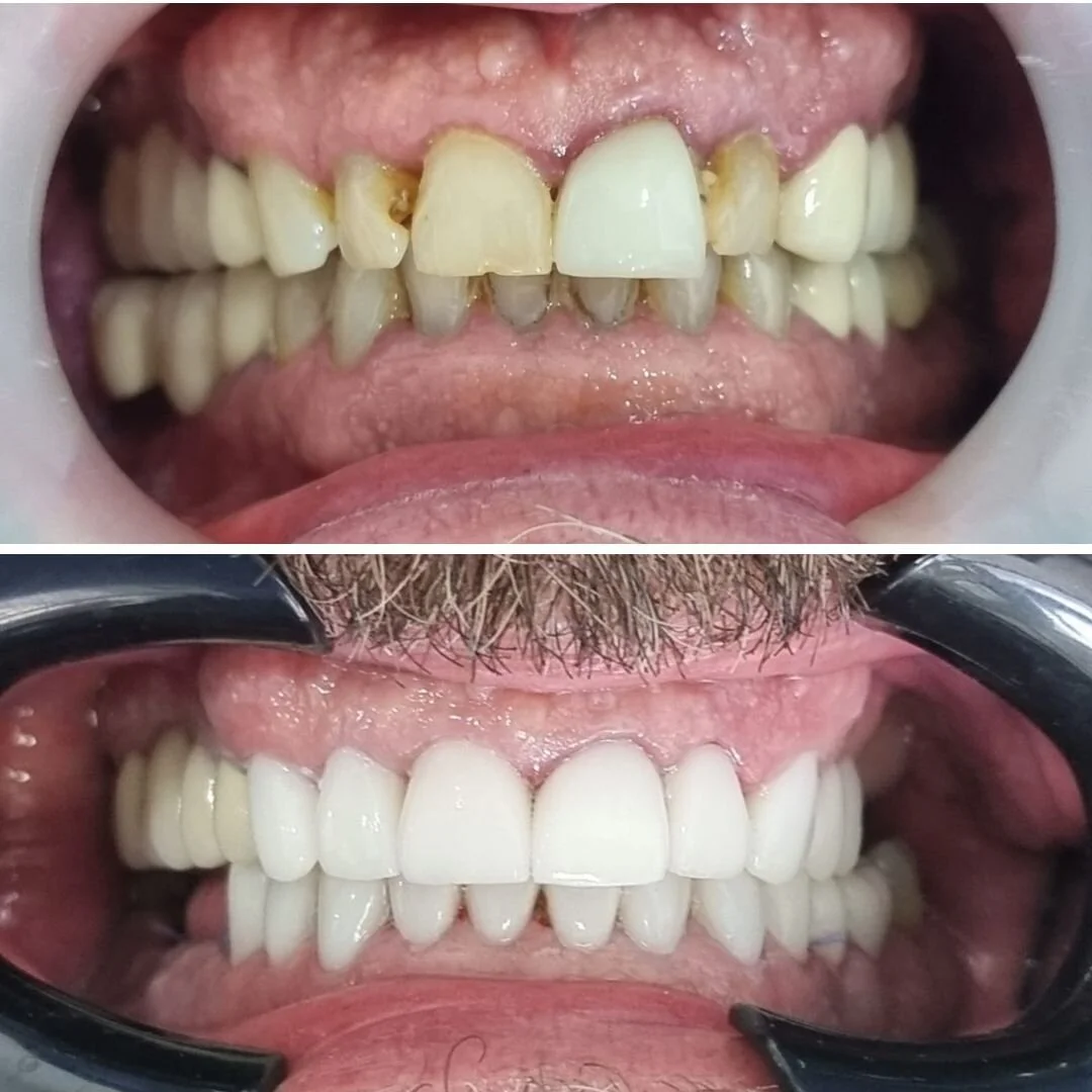 Reviews — Dental Tourism Colombia