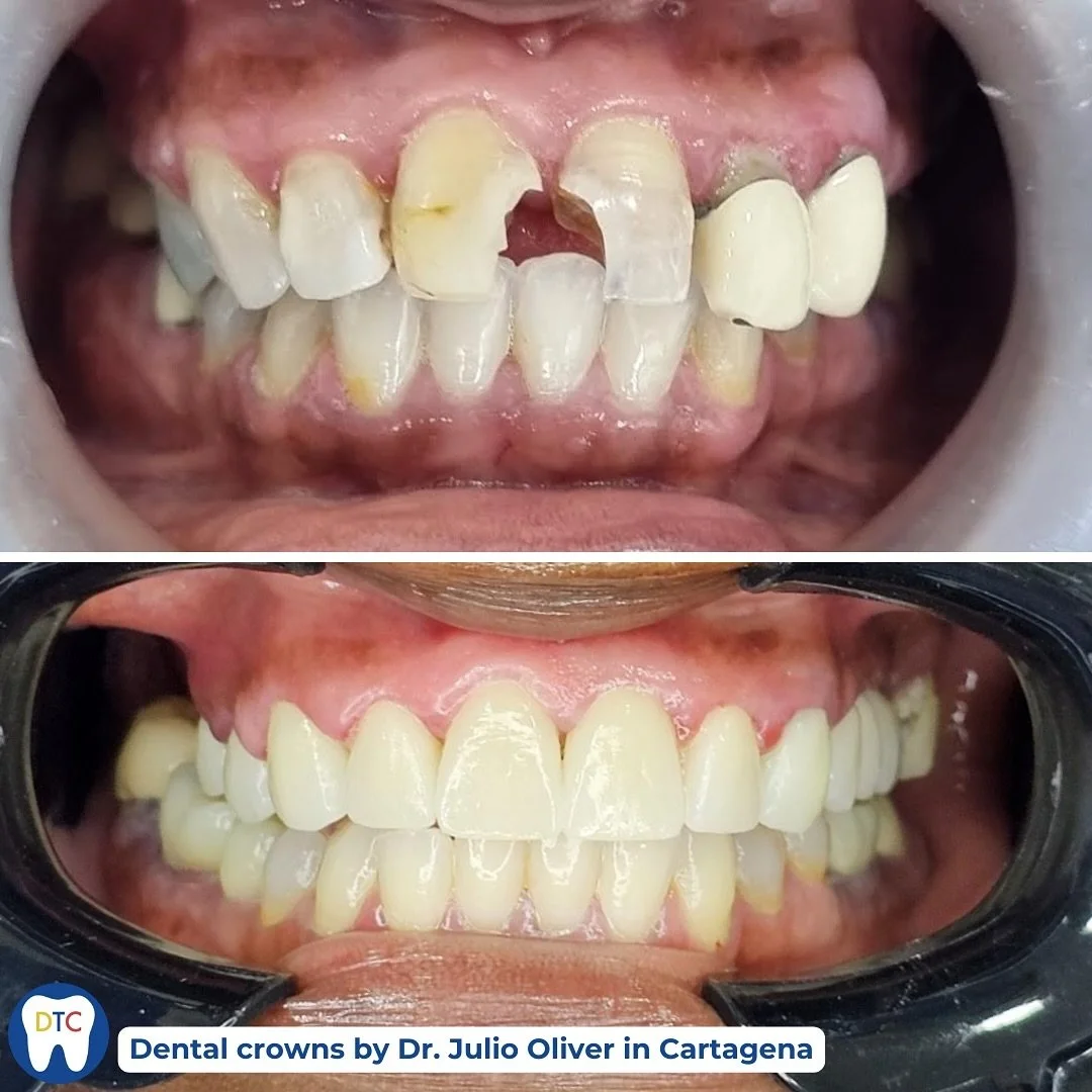 Reviews — Dental Tourism Colombia