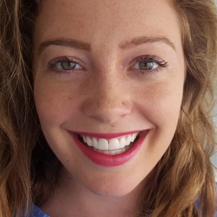 How Much Is a Full Set of Veneers in Colombia? - Dental Tourism Colombia