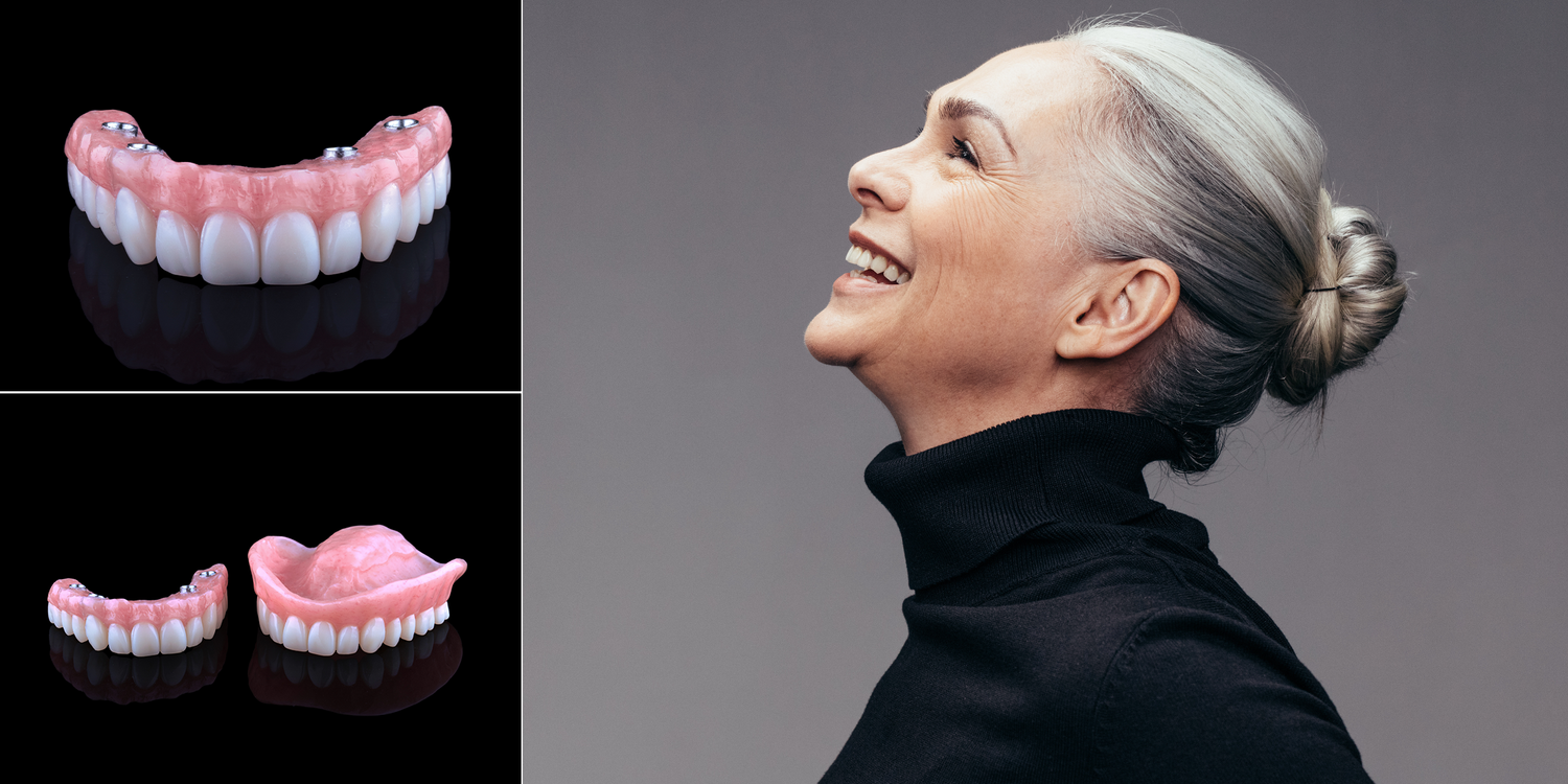 Chairside Conversions — MicroDental California Site